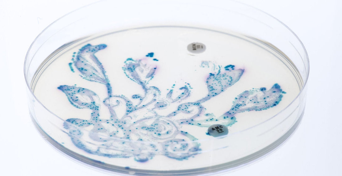 How Do We See Intelligent Design in Nature?